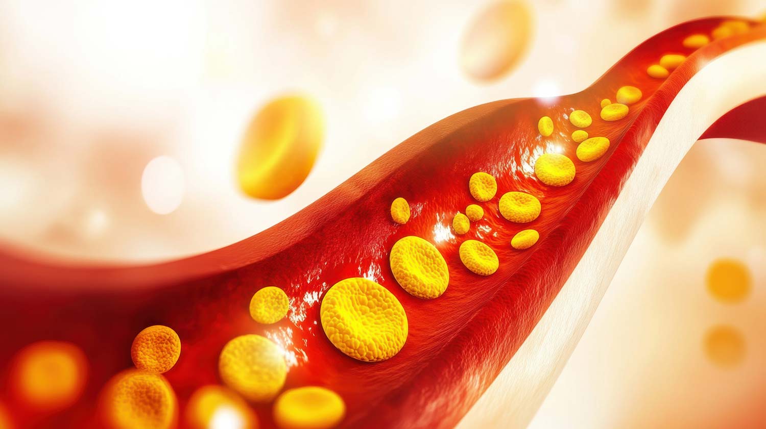 How Triglycerides Affect Your Health